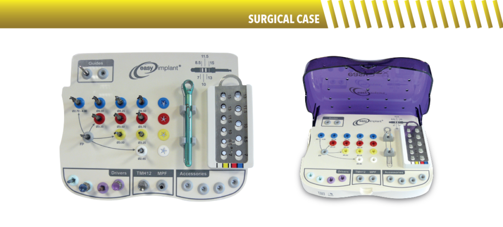 Easy Implant – MY Dental